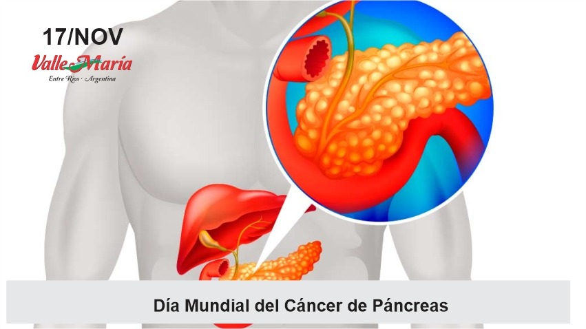 Día Mundial del Cáncer de Páncreas | Municipalidad de Valle María
